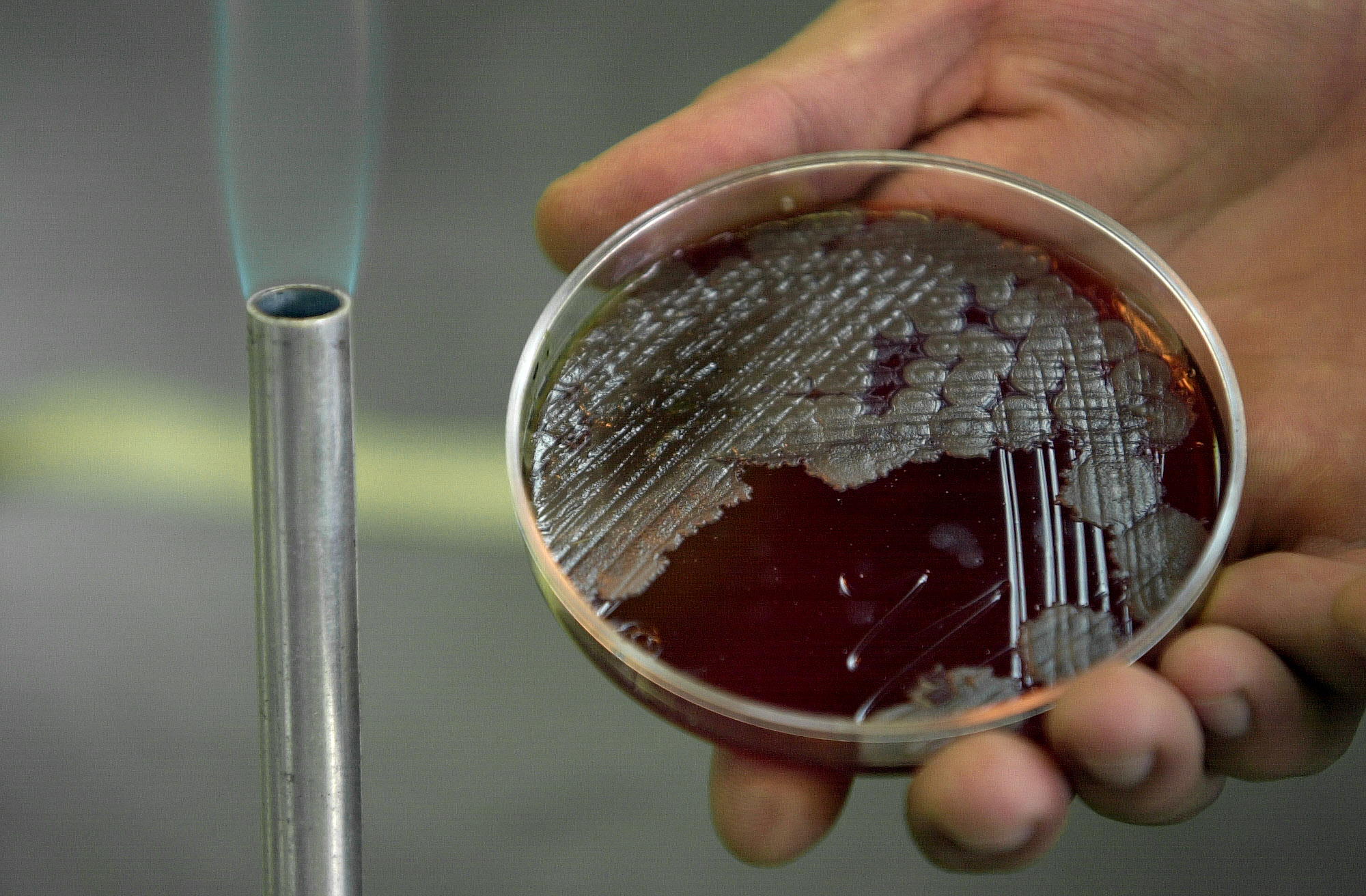 Pentagon: Military Accidentally Shipped Live Anthrax To 9 Labs - TPM ...